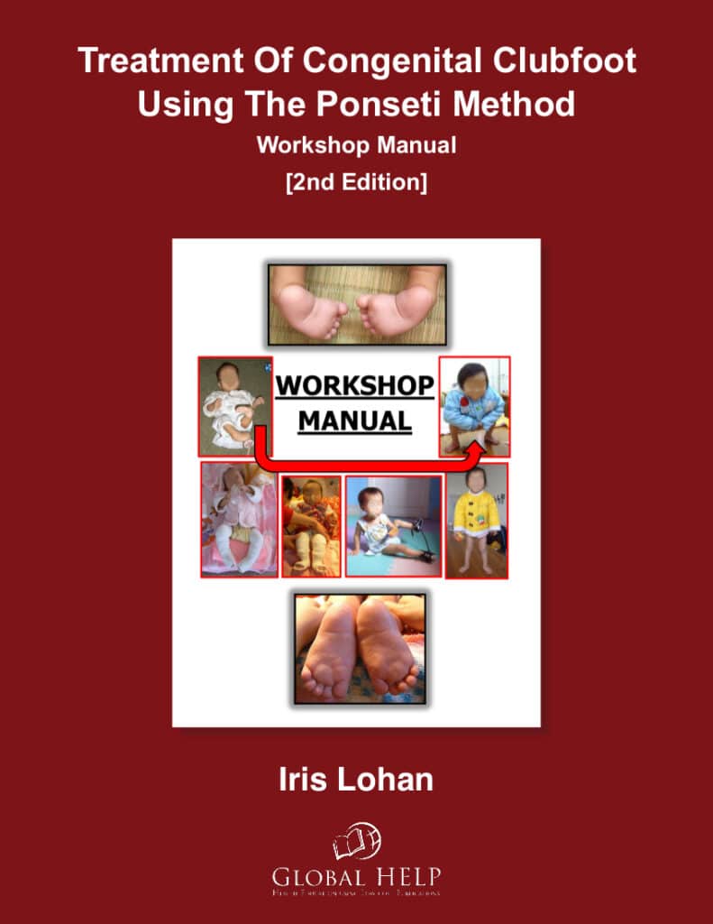 Helpful Resources - Steps | Clubfoot support in Southern Africa