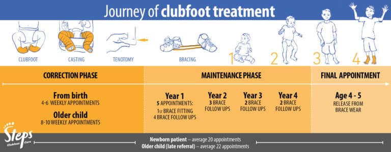 Clubfoot treatment - Steps | Clubfoot support in Southern Africa