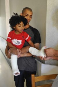 Clubfoot treatment - Steps | Clubfoot support in Southern Africa