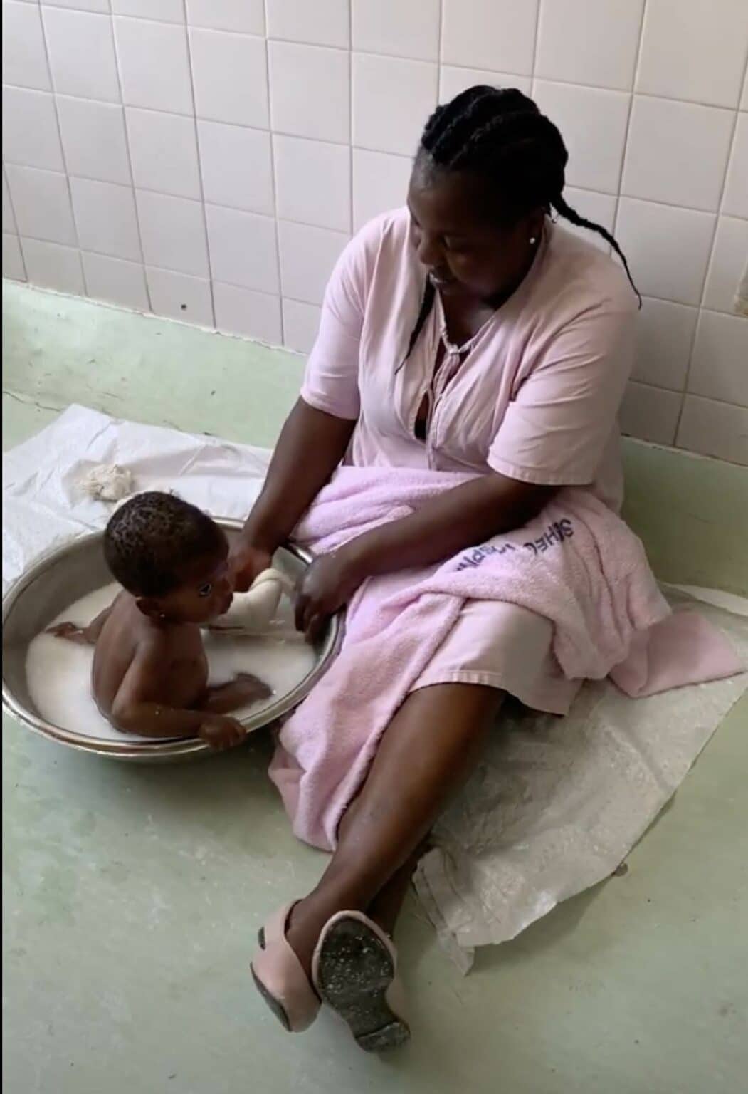Clubfoot treatment - Steps | Clubfoot support in Southern Africa