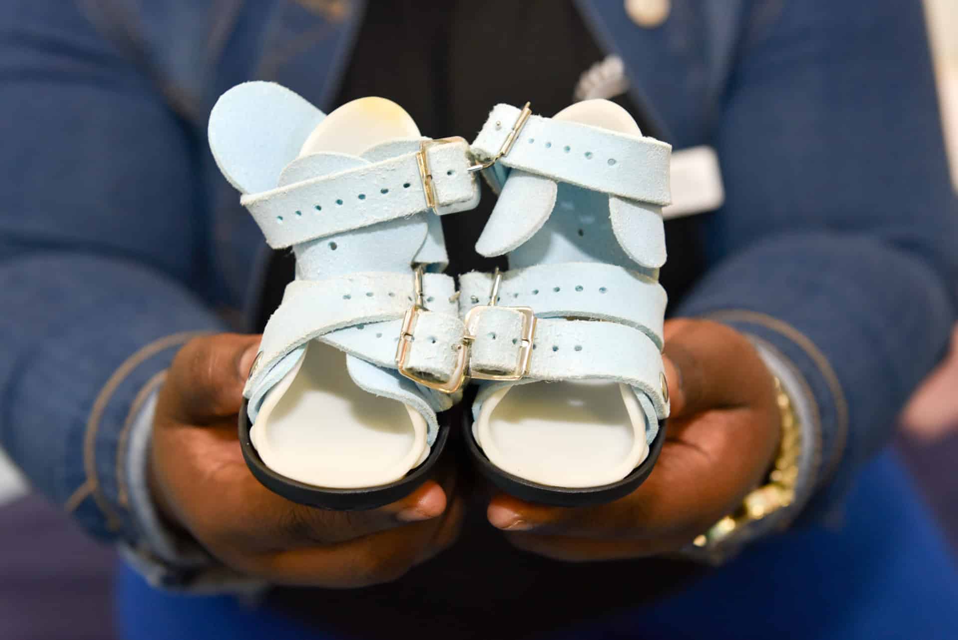 Clubfoot Braces - Steps | Clubfoot support in Southern Africa