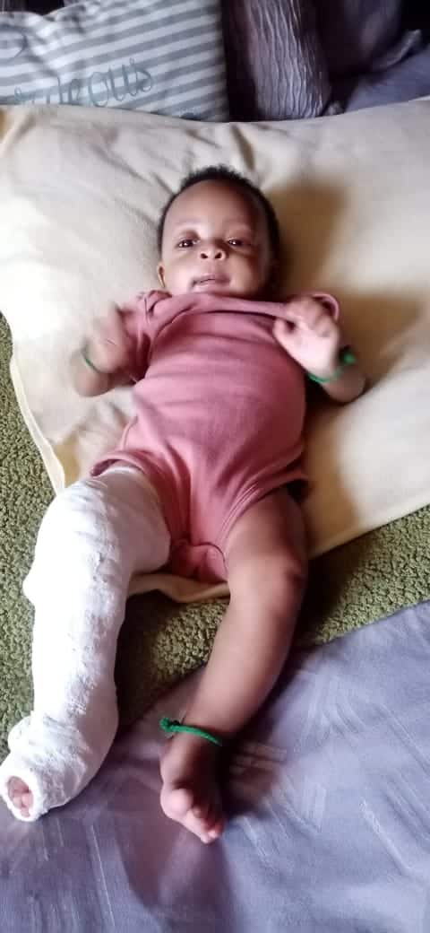 Meet Tisetso Rose: A Clubfoot Champion in the Making! - Steps ...